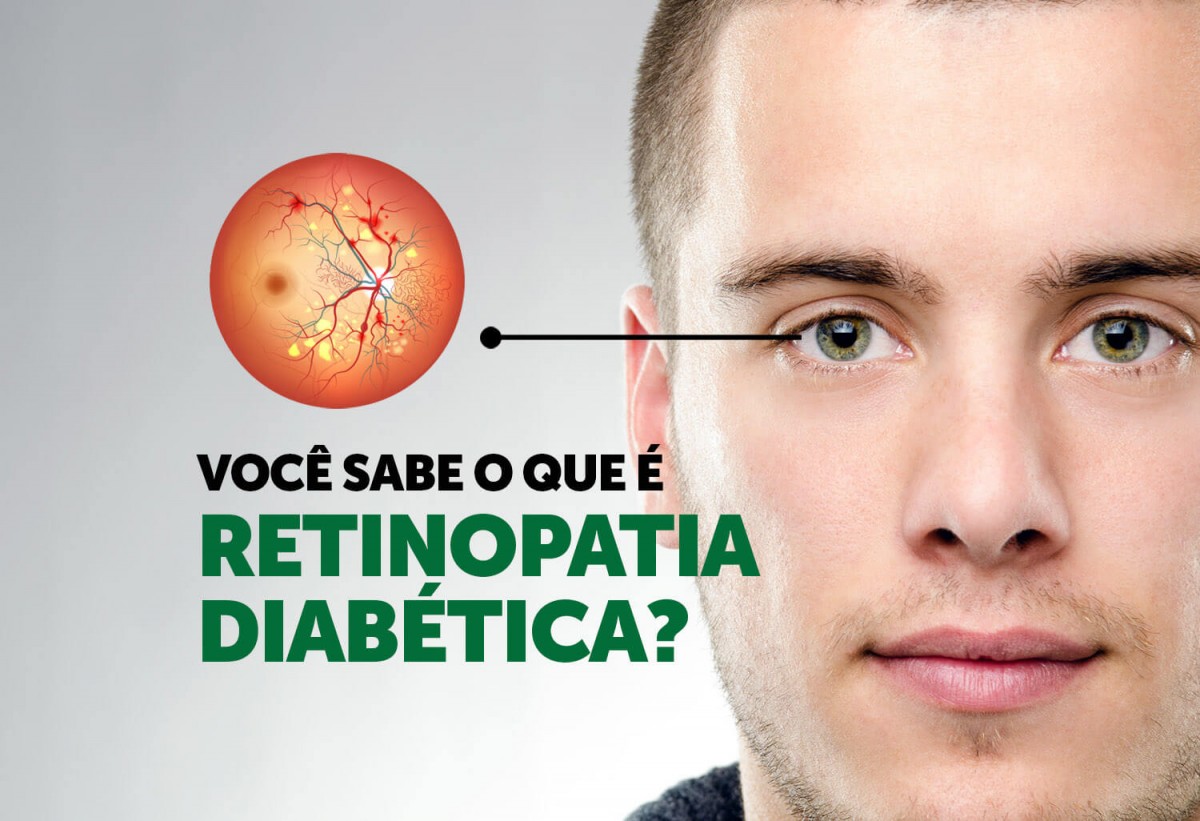 Você sabe o que é Retinopatia Diabética? - Hospital Santa Virgínia