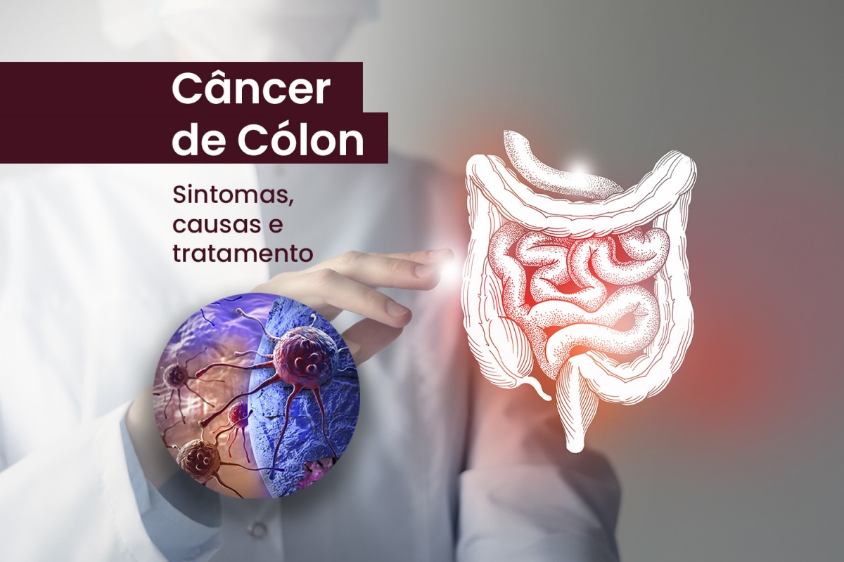 Câncer de Cólon – Sintomas, causas e tratamento - Hospital Santa Virgínia
