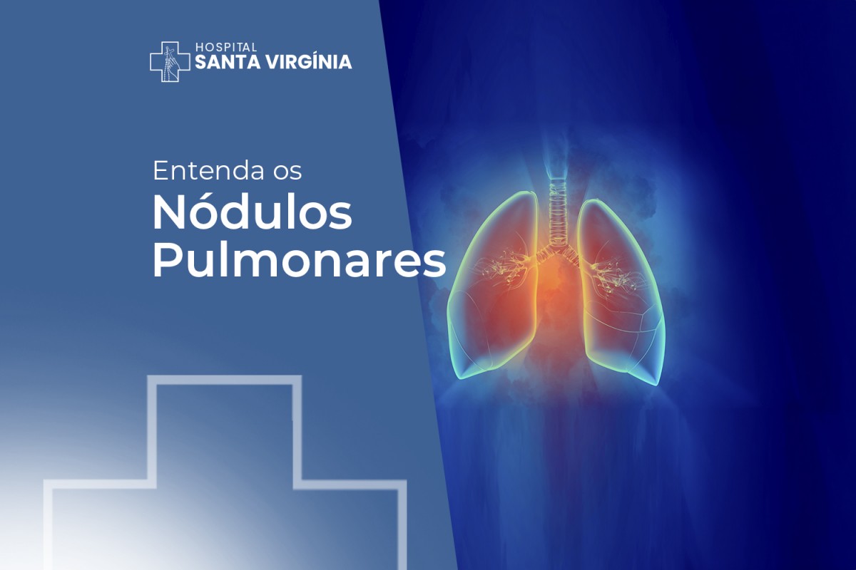 Nódulos Pulmonares - Hospital Santa Virgínia
